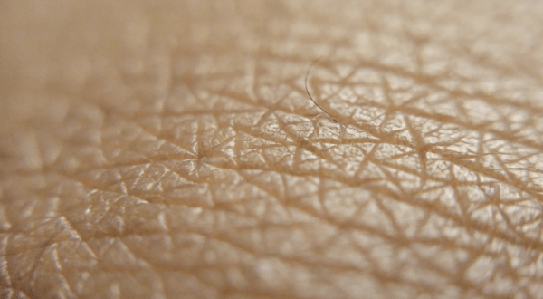 Allodynia in Fibromyalgia: Why Your Skin Hurts, and What Actually Helps ...